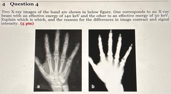 Solved Two X-ray images of the hand are shown in below | Chegg.com