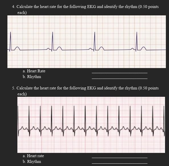 4. Calculate the heart rate for the following EKG and | Chegg.com