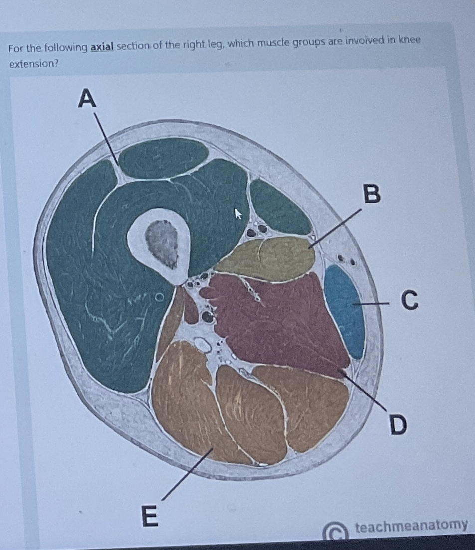 Solved For the following axial section of the right leg, | Chegg.com