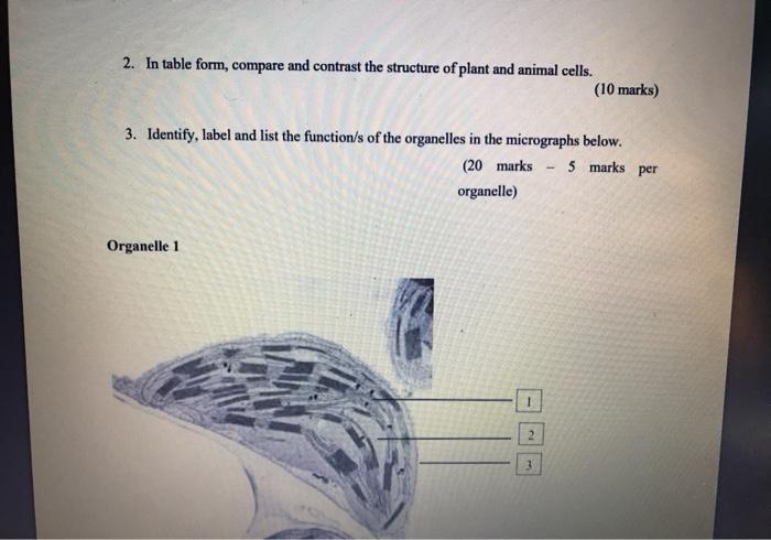 Solved 1. Below is an electron micrograph of a | Chegg.com