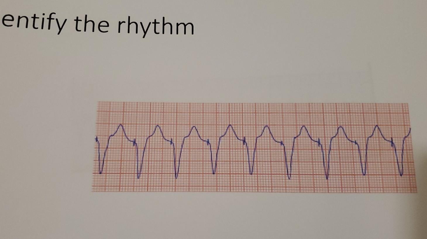 Solved entify the rhythm MW | Chegg.com