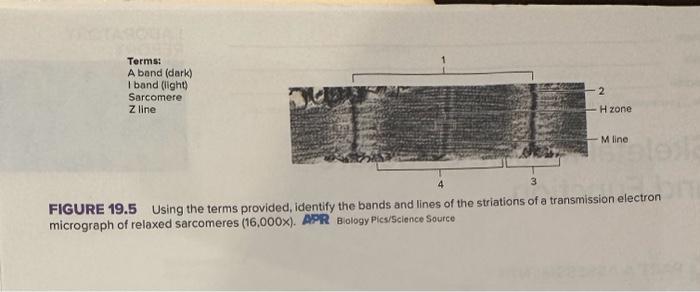 Solved Terms: A band (dark) I band (light) Sarcomere Z line | Chegg.com