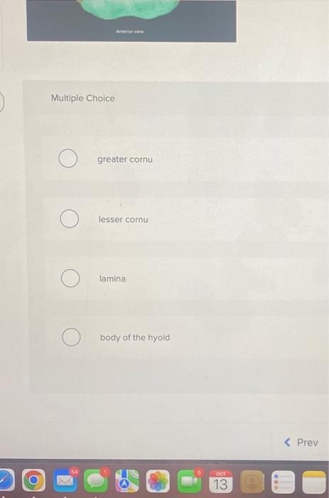 Solved Which structure is highlighted? Multiple Choice | Chegg.com