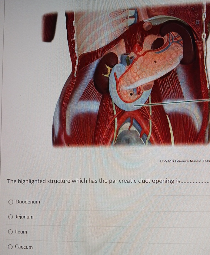 Solved The highlighted structure which has the pancreatic | Chegg.com