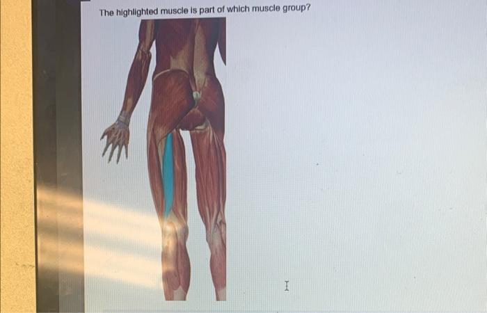 Solved The highlighted muscle is part of which muscle | Chegg.com
