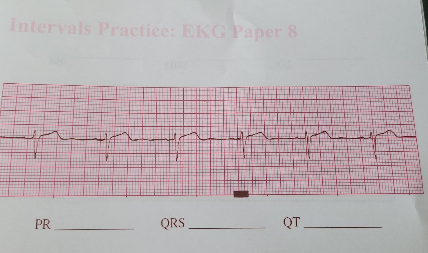 Solved Intervals Practice: EKG Paper 1 UA میرا یہ A A PR QRS | Chegg.com