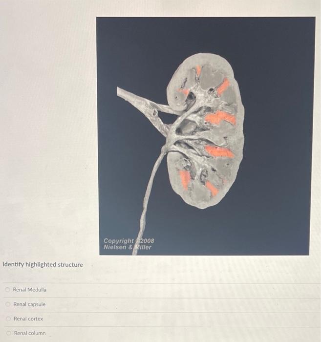 Solved Identify highlighted structure Renal Medulla Renal | Chegg.com