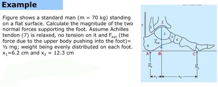 Solved Figure shows a standard man(m=70 kg) standing on a | Chegg.com