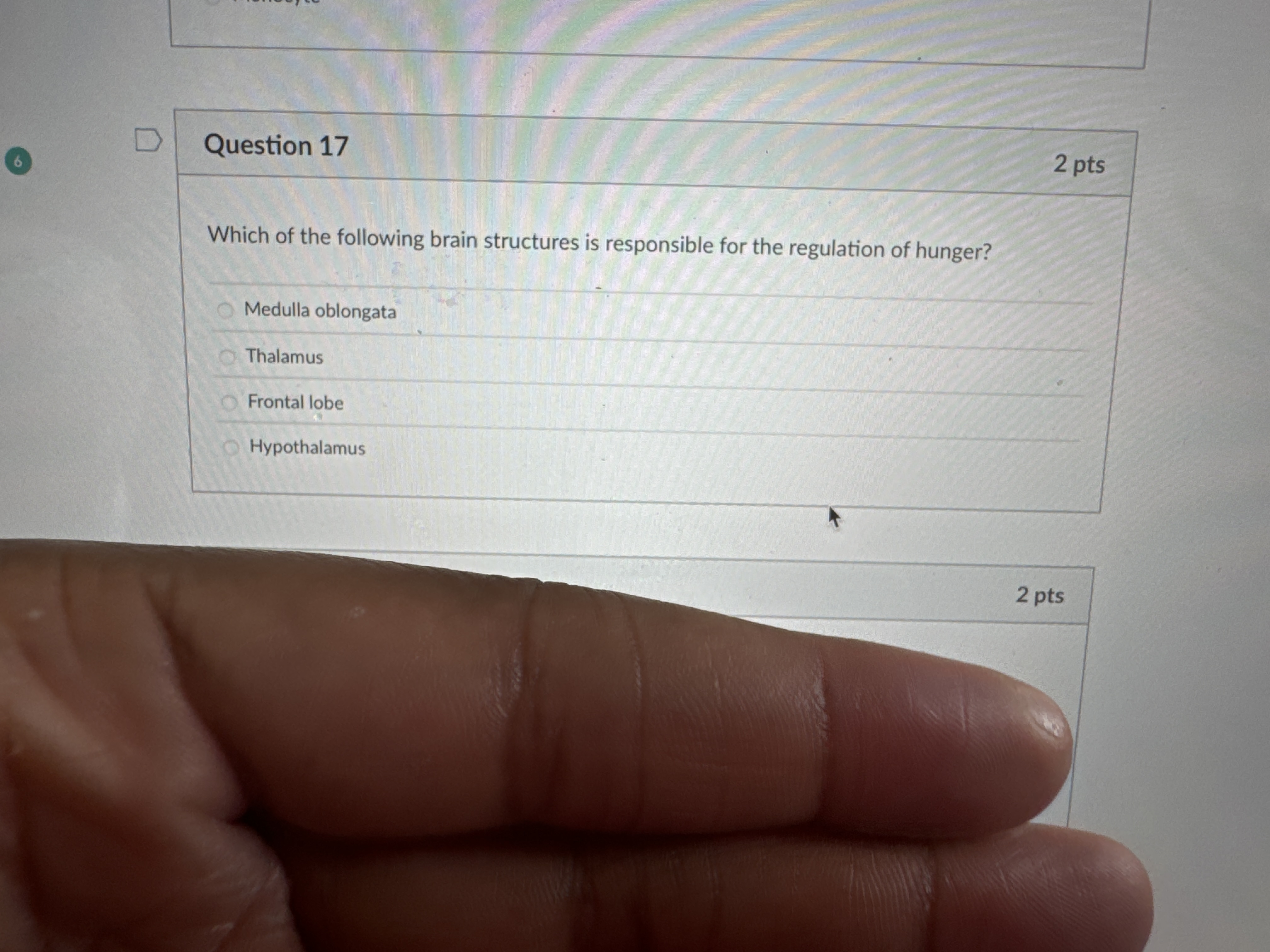 Solved Question 17Which of the following brain structures is | Chegg.com