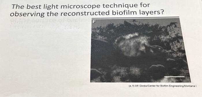 Solved The best light microscope technique for observing the | Chegg.com