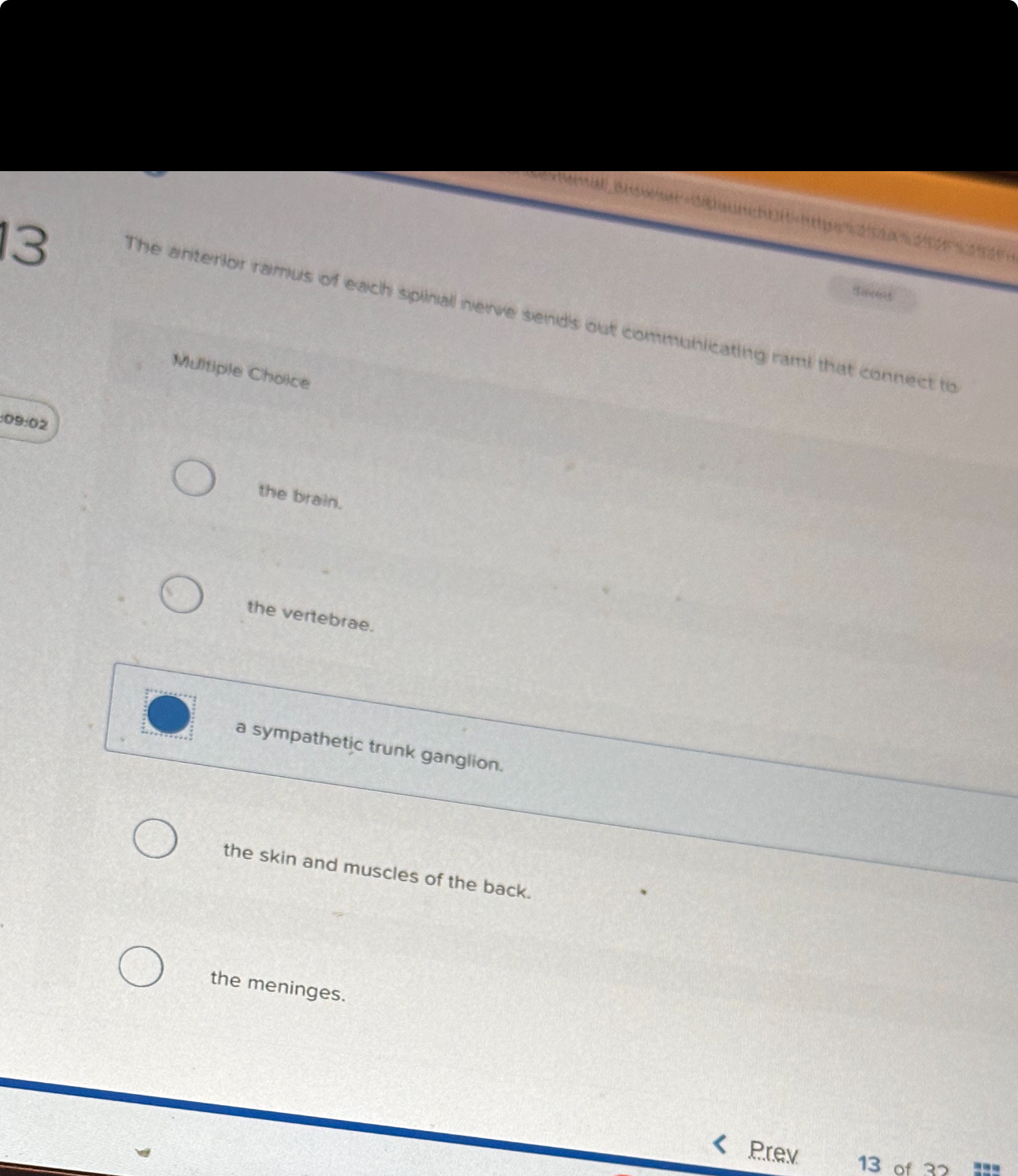 Solved 13The aniterior ramus of earch soinal nerve senids | Chegg.com