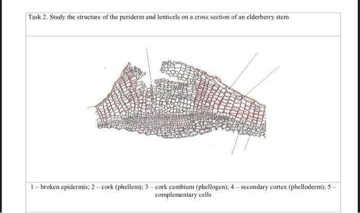 Solved Task 2. Study the structure of the periderm and | Chegg.com