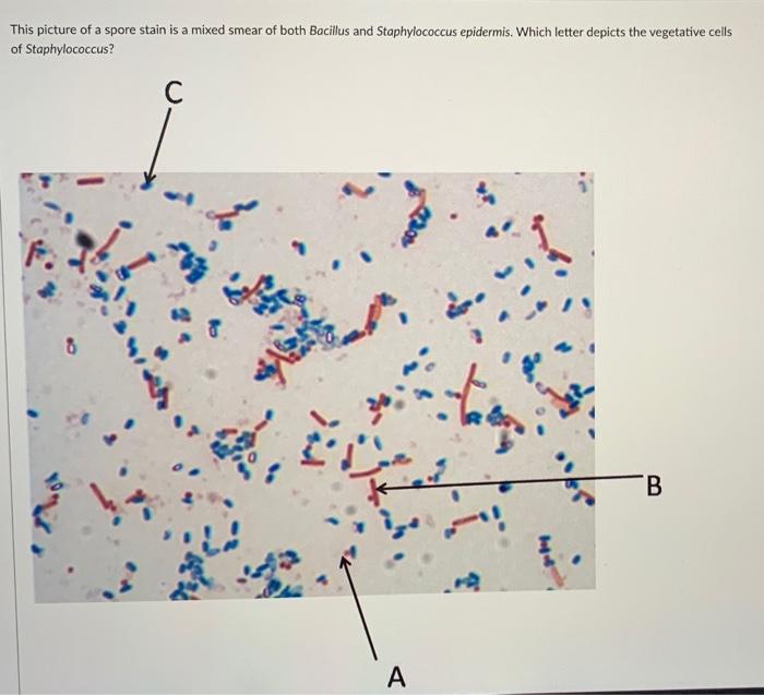 Solved This picture of a spore stain is a mixed smear of | Chegg.com