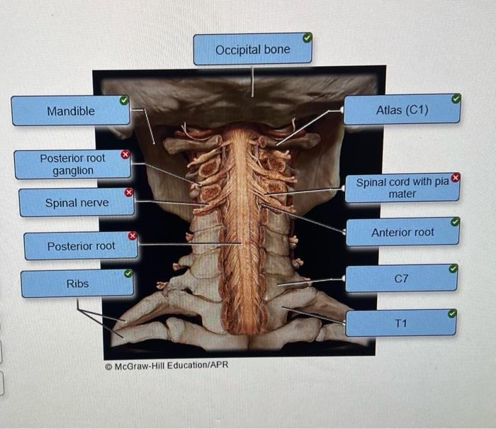 Solved Which structure is highlighted? Multiple Chace | Chegg.com