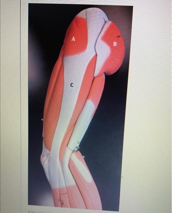 Solved please help me identify the muscles leg | Chegg.com Solved please help me identify the muscles leg | Chegg.com