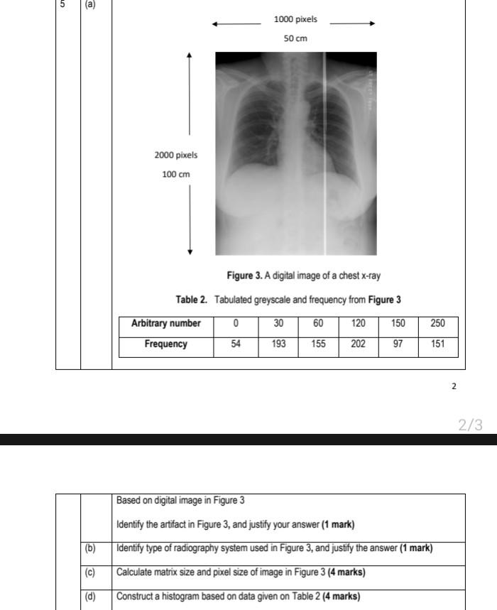 Solved Figure 3. A digital image of a chest x-ray Table 2. | Chegg.com