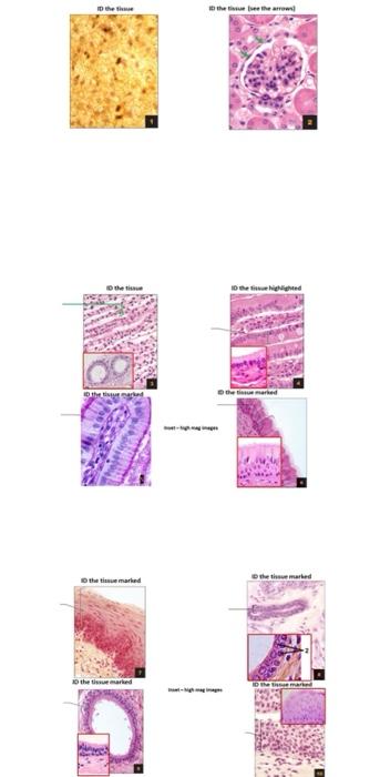 Solved Identify the different tissues and cell types | Chegg.com