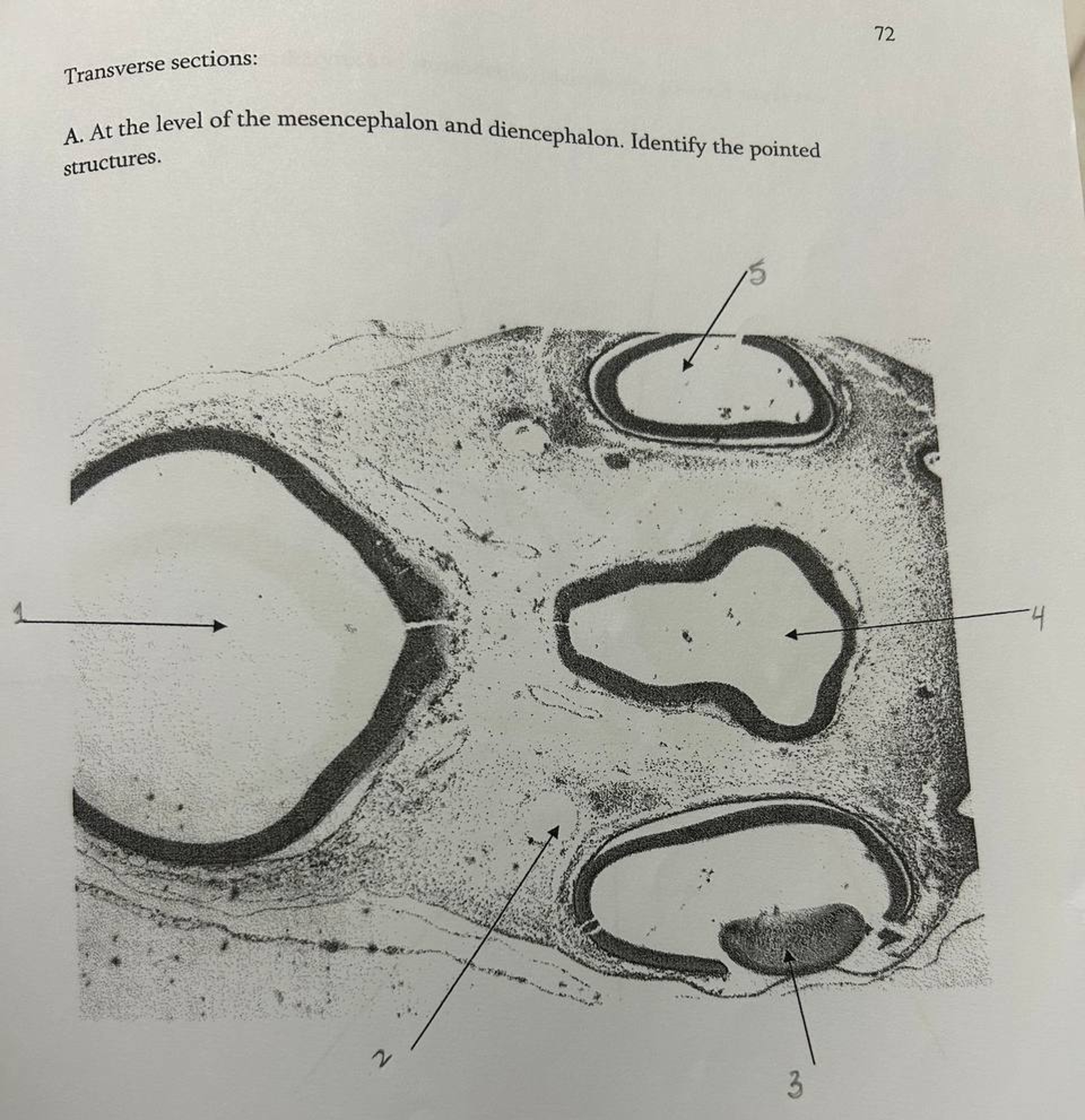 Label the 96 ﻿hour chick embryoA. ﻿At the level of | Chegg.com