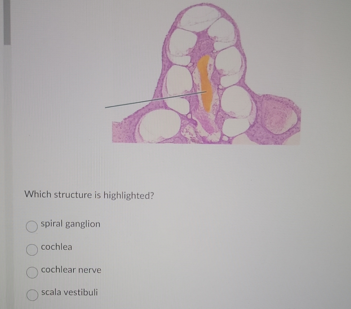 Solved Which structure is highlighted?spiral | Chegg.com