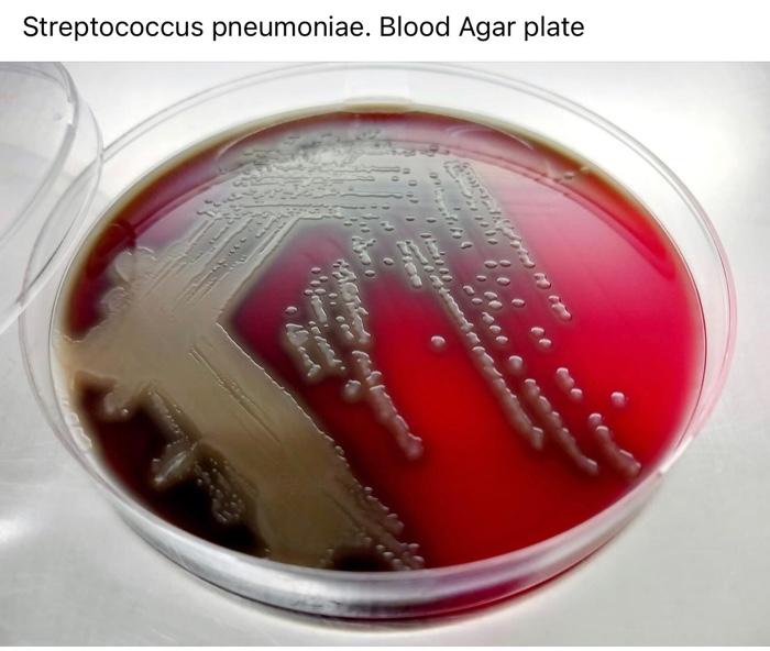 Solved Streptococcus pneumoniae. Blood Agar plate | Chegg.com