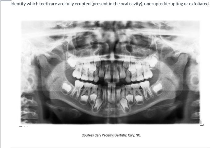 Identify which teeth are are fully erupted (present | Chegg.com