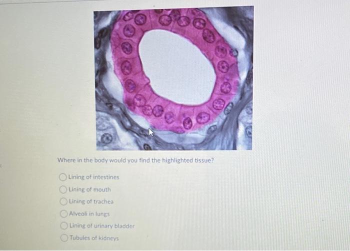Solved Identify the highlighted tissue type 5: | Chegg.com