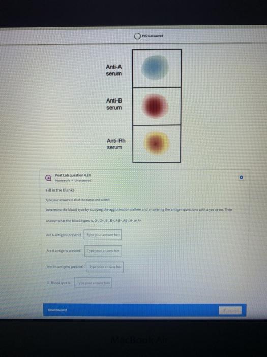 Solved Anti-A serum Anti-B serum Anti-Rh serum Posta | Chegg.com