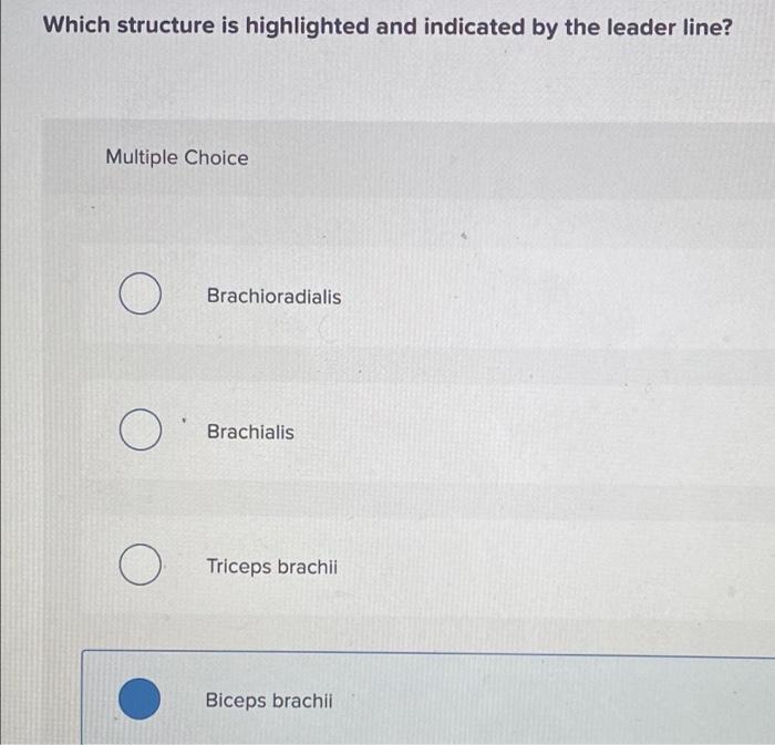 Solved N Which structure is highlighted and indicated by | Chegg.com