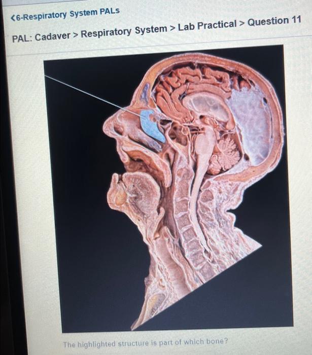 Solved Respiratory | Chegg.com