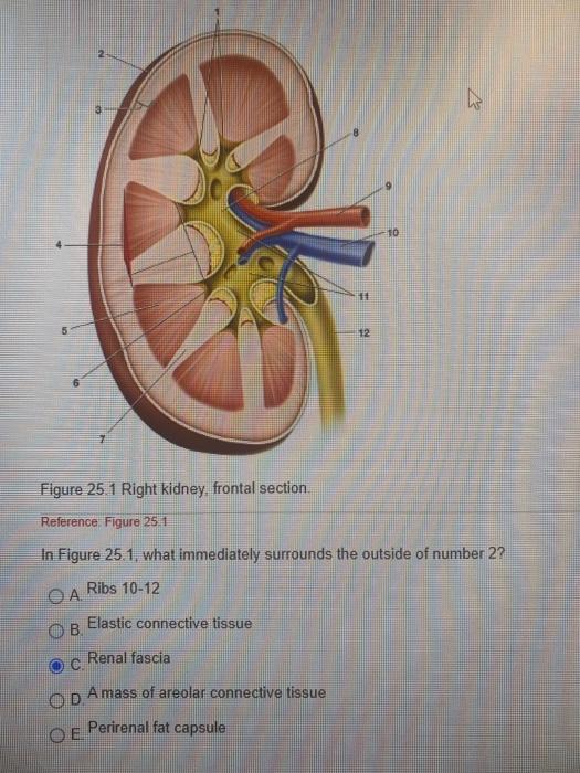 Solved TO 11 12 Figure 25.1 Right kidney, frontal section | Chegg.com