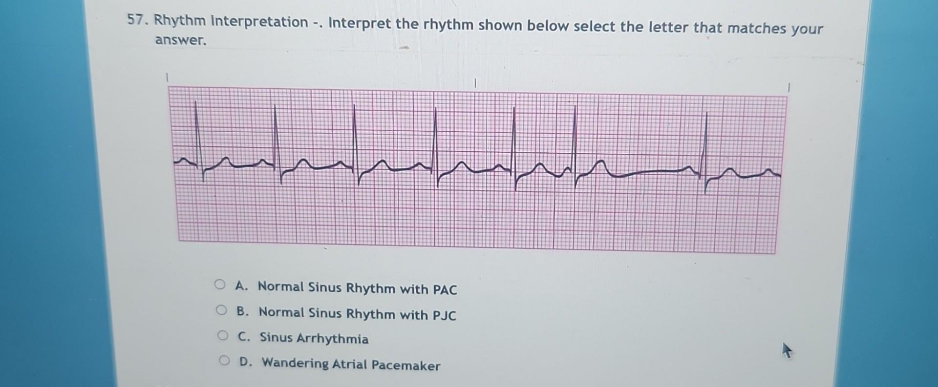 Solved 7. Rhythm interpretation -. Interpret the rhythm | Chegg.com