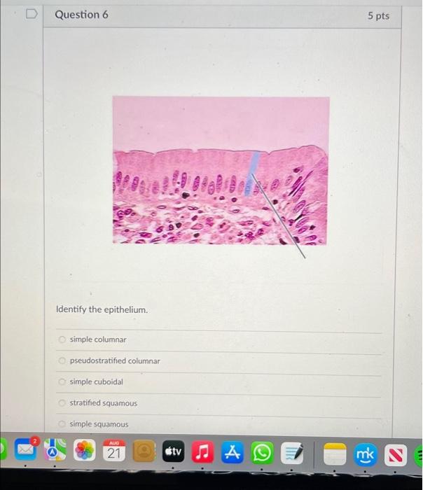 Solved Identify the epithelium. simple columnar | Chegg.com