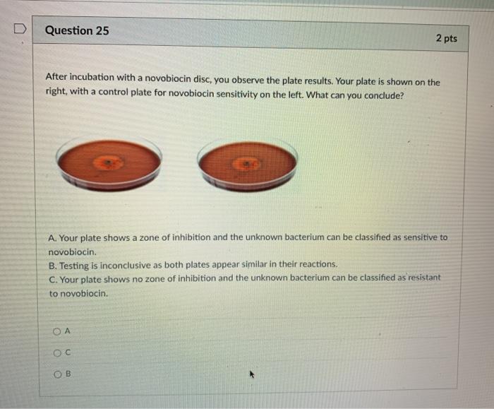 Solved Question 25 2 pts After incubation with a novobiocin | Chegg.com