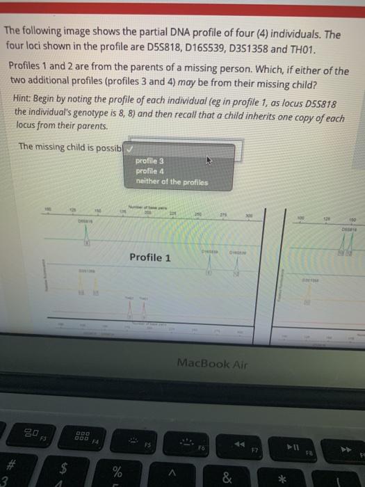 Solved The following image shows the partial DNA profile of | Chegg.com