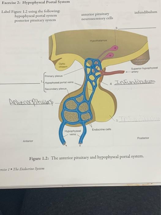 Solved Exercise 2: Hypophyscal Portal System infundibulum | Chegg.com