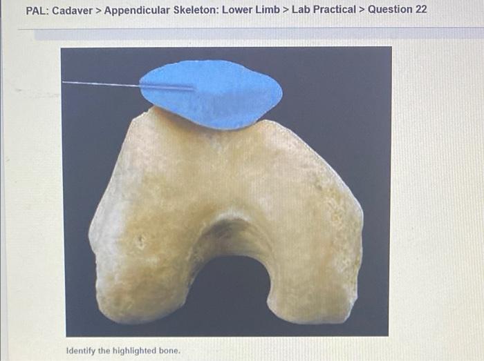 Solved PAL: Cadaver > Appendicular Skeleton: Pelvic Girdle > | Chegg.com