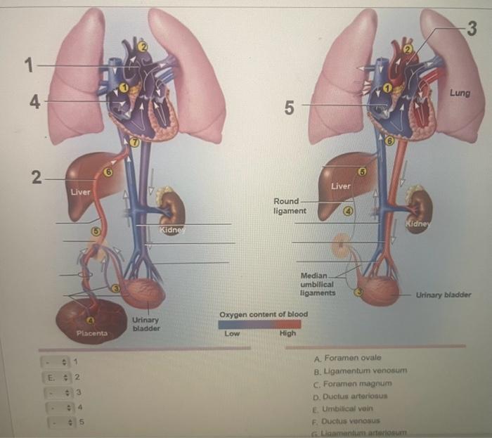 Solved A. Foramen ovale B. Ligamentum venosum C. Foramen | Chegg.com