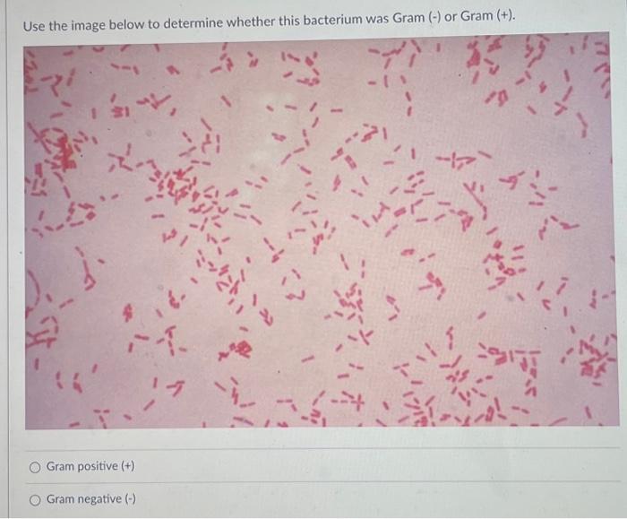 Solved Use the image below to determine whether this | Chegg.com