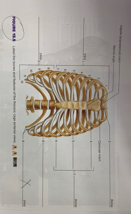 Solved Jugular (suprasternal) notch- Sternal angle (bone) | Chegg.com