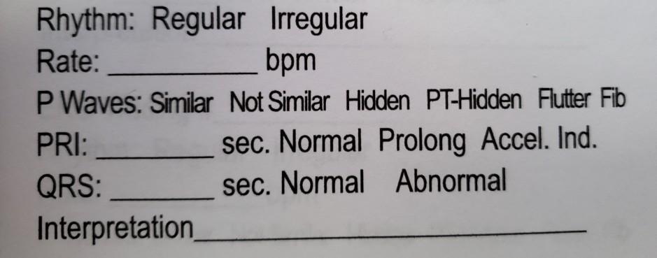 Solved Rhythm: Regular Irregular Rate: bpm P Waves: Similar | Chegg.com