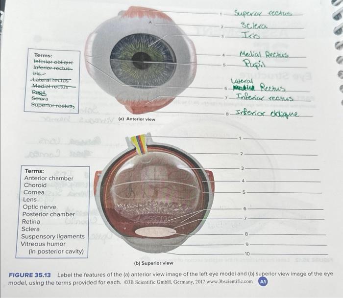 Solved Terms: Inferior oblique Inferior rectus Iris Lateral | Chegg.com