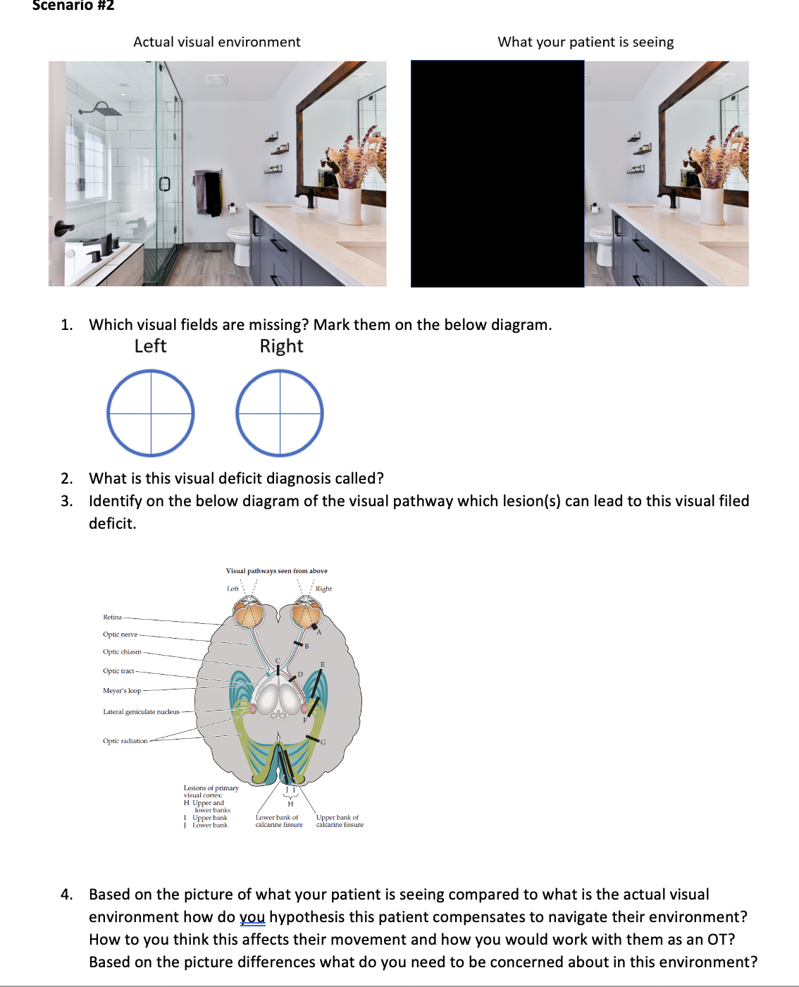 Solved Which visual fields are missing? Mark them on the | Chegg.com