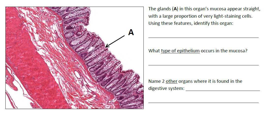 Solved The glands (A) ﻿in this organ's mucosa appear | Chegg.com