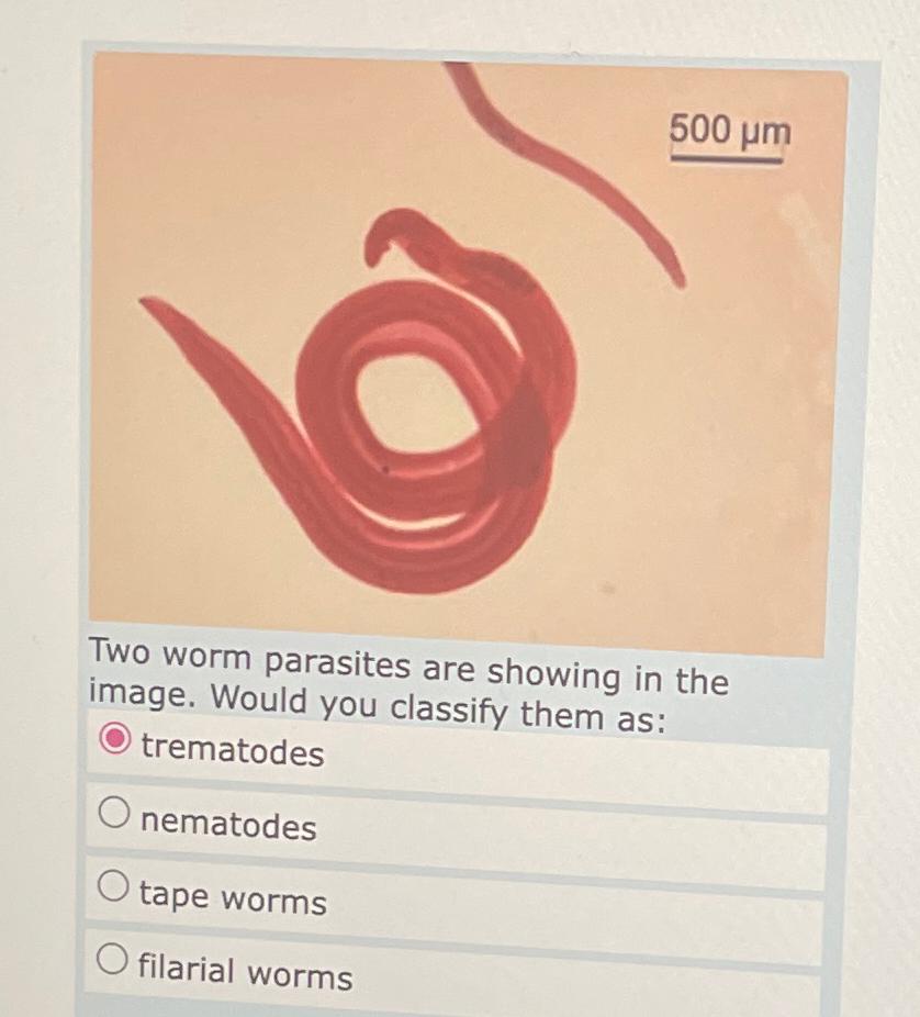Solved Two worm parasites are showing in the image. Would | Chegg.com