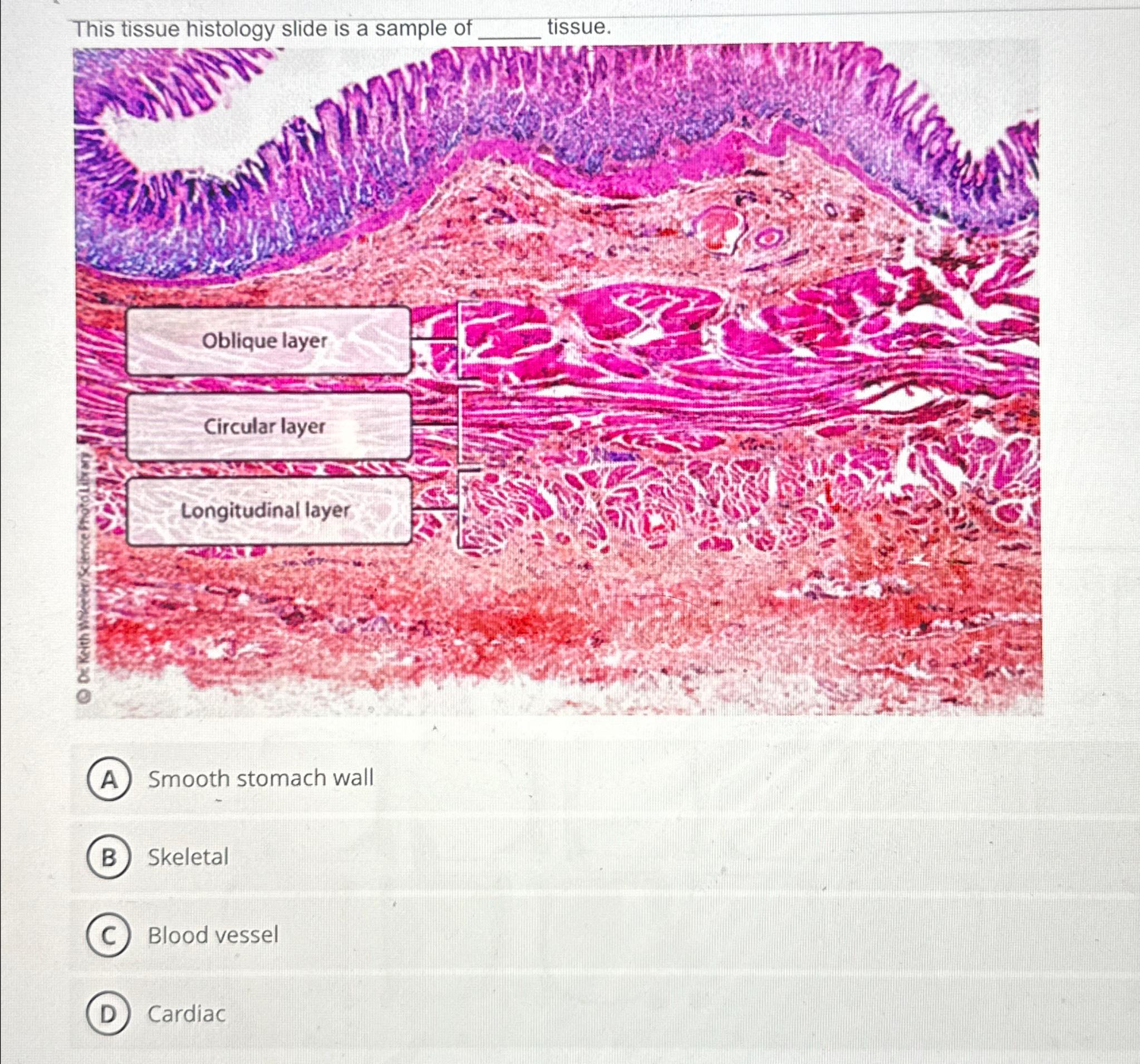 Solved This tissue histology slide is a sample of | Chegg.com