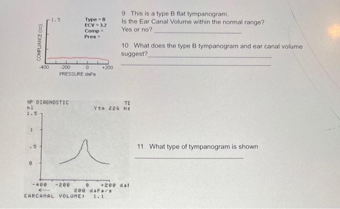 Solved 9 This Is A Type B Flat Tympanogram Is The Ear Canal