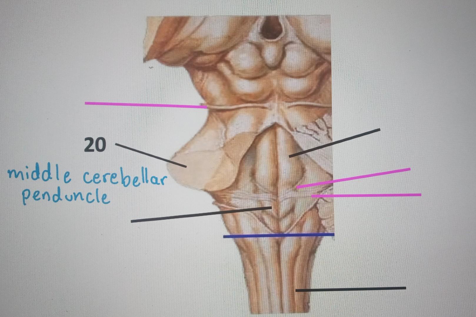 Solved Please label the structures pointed by all the black | Chegg.com