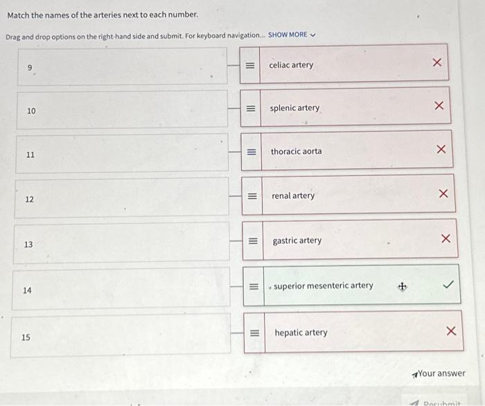 Solved Match the names of the arteries next to each number. | Chegg.com
