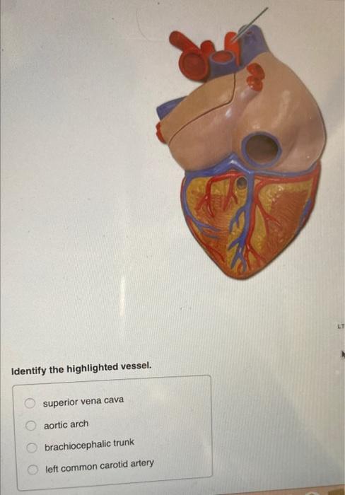 Solved Identify the highlighted vessel. superior vena cava | Chegg.com