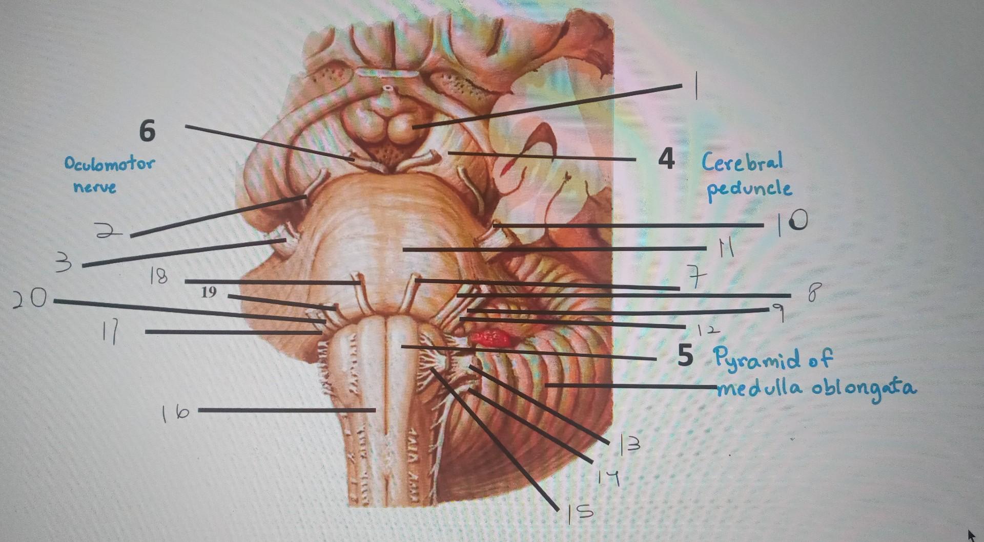 Solved Please label the structures pointed by all the black | Chegg.com